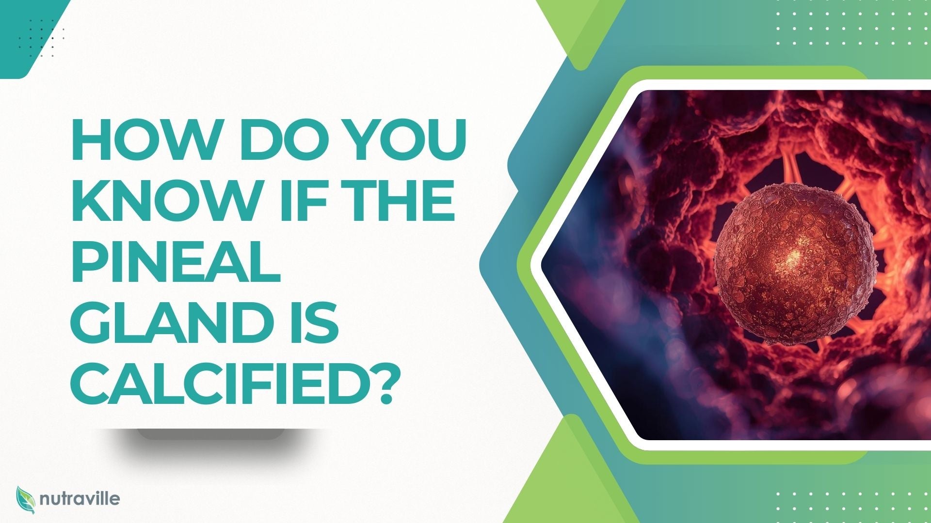 How Do You Know If the Pineal Gland Is Calcified? – Nutraville